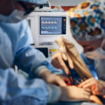 Electrosurgical Units: How They Work and Safety Guidelines